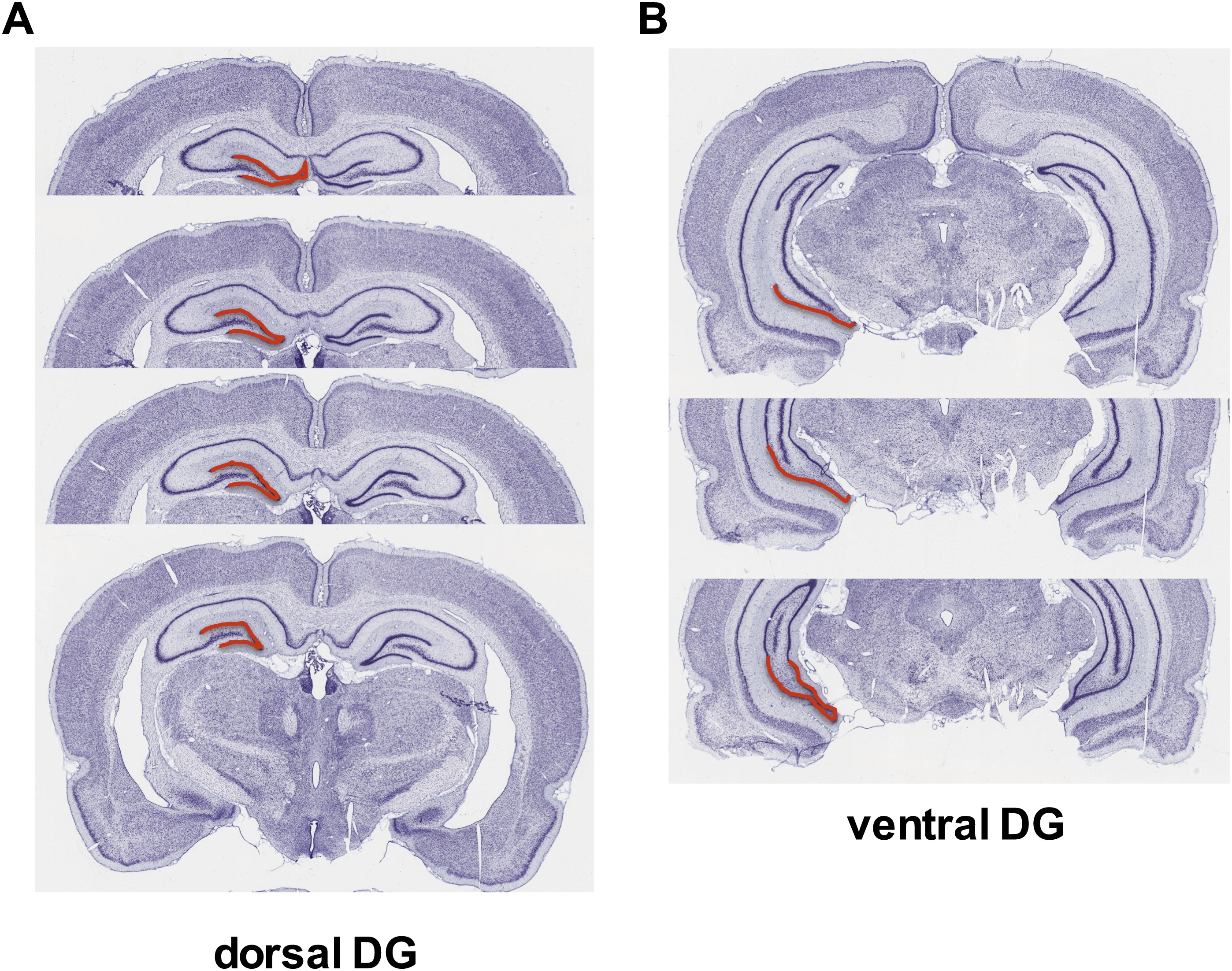 Acute stress enhances adult rat hippocampal neurogenesis and activation ...