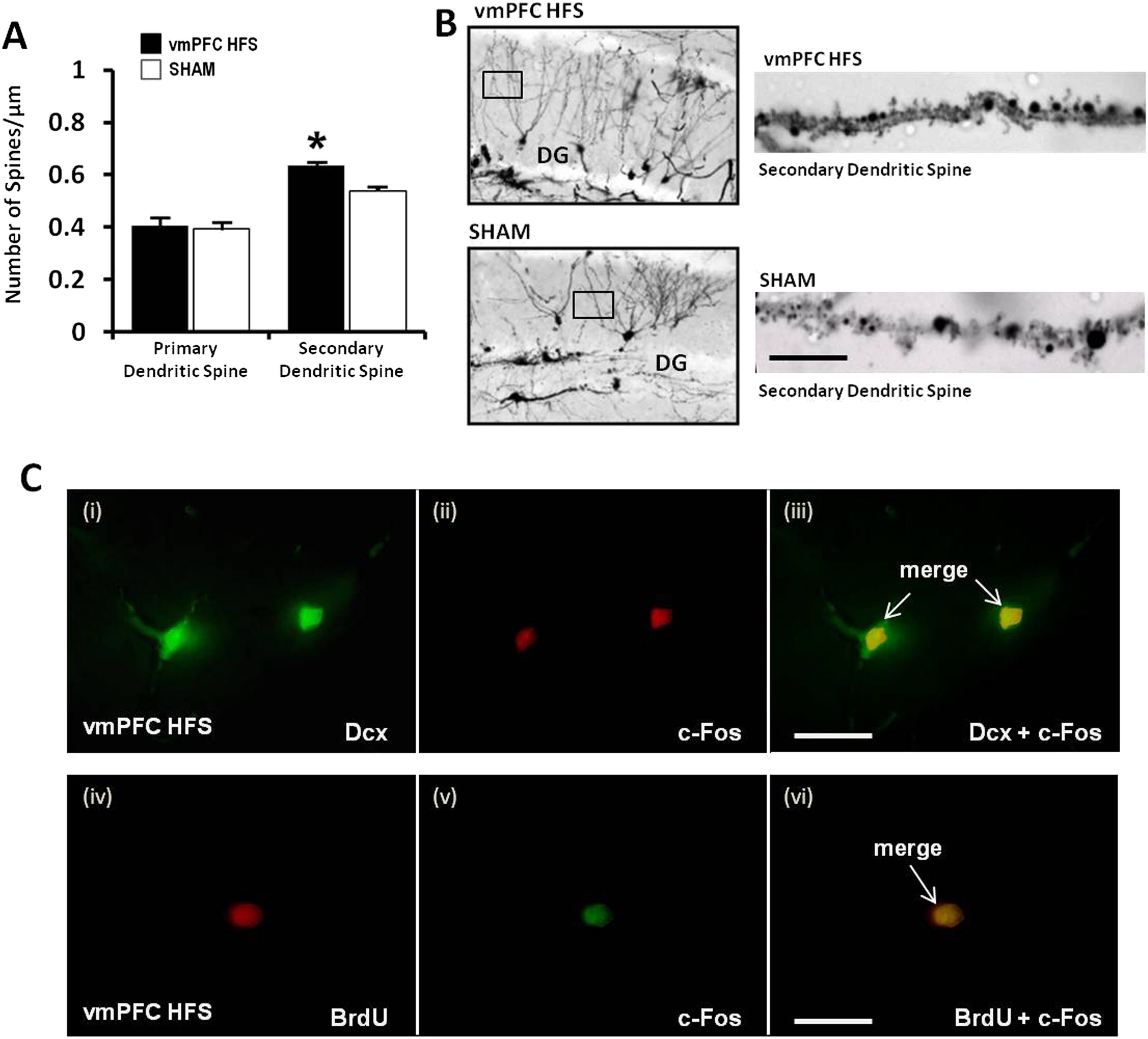Ventromedial prefrontal cortex stimulation enhances memory and ...