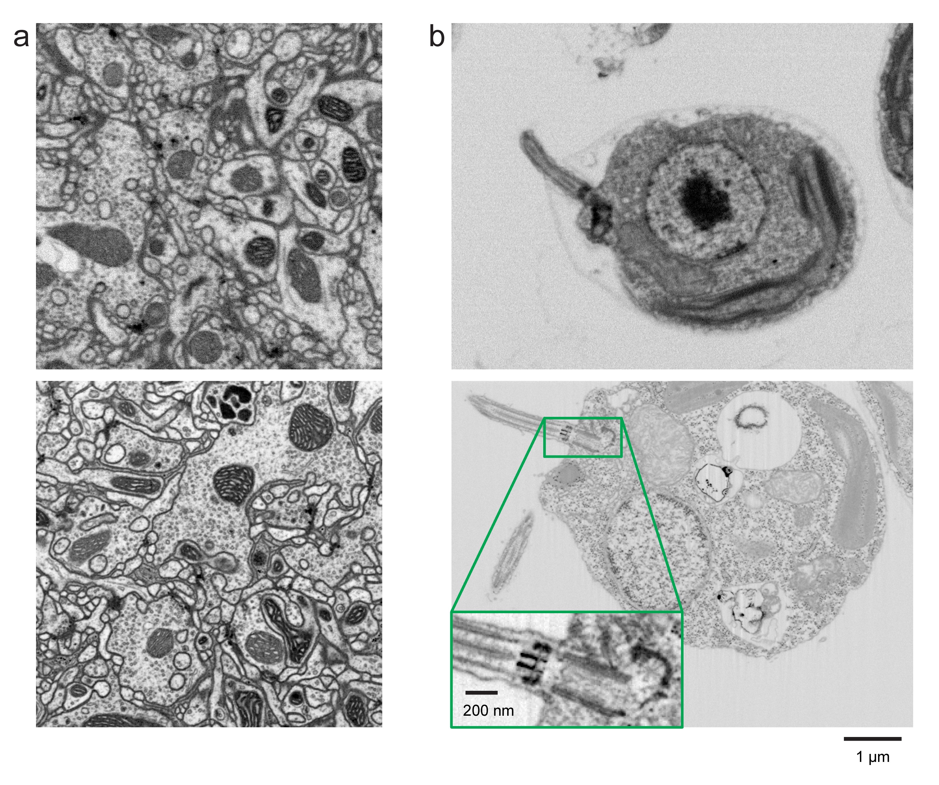 Enhanced FIB-SEM systems for large-volume 3D imaging | eLife Lens