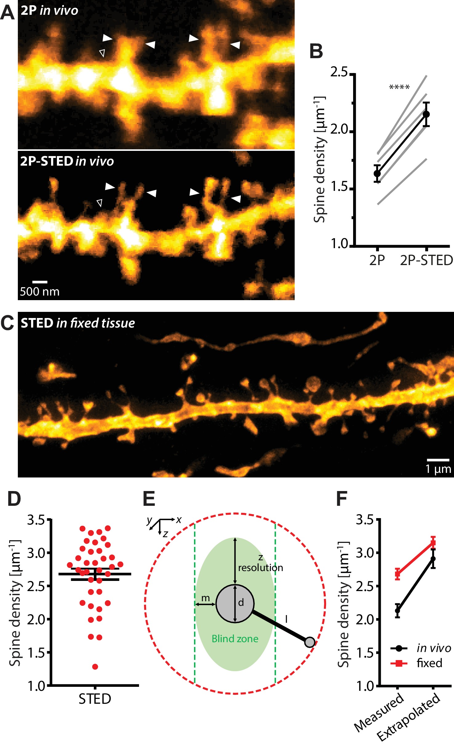 Chronic 2P-STED imaging reveals high turnover of dendritic spines in ...