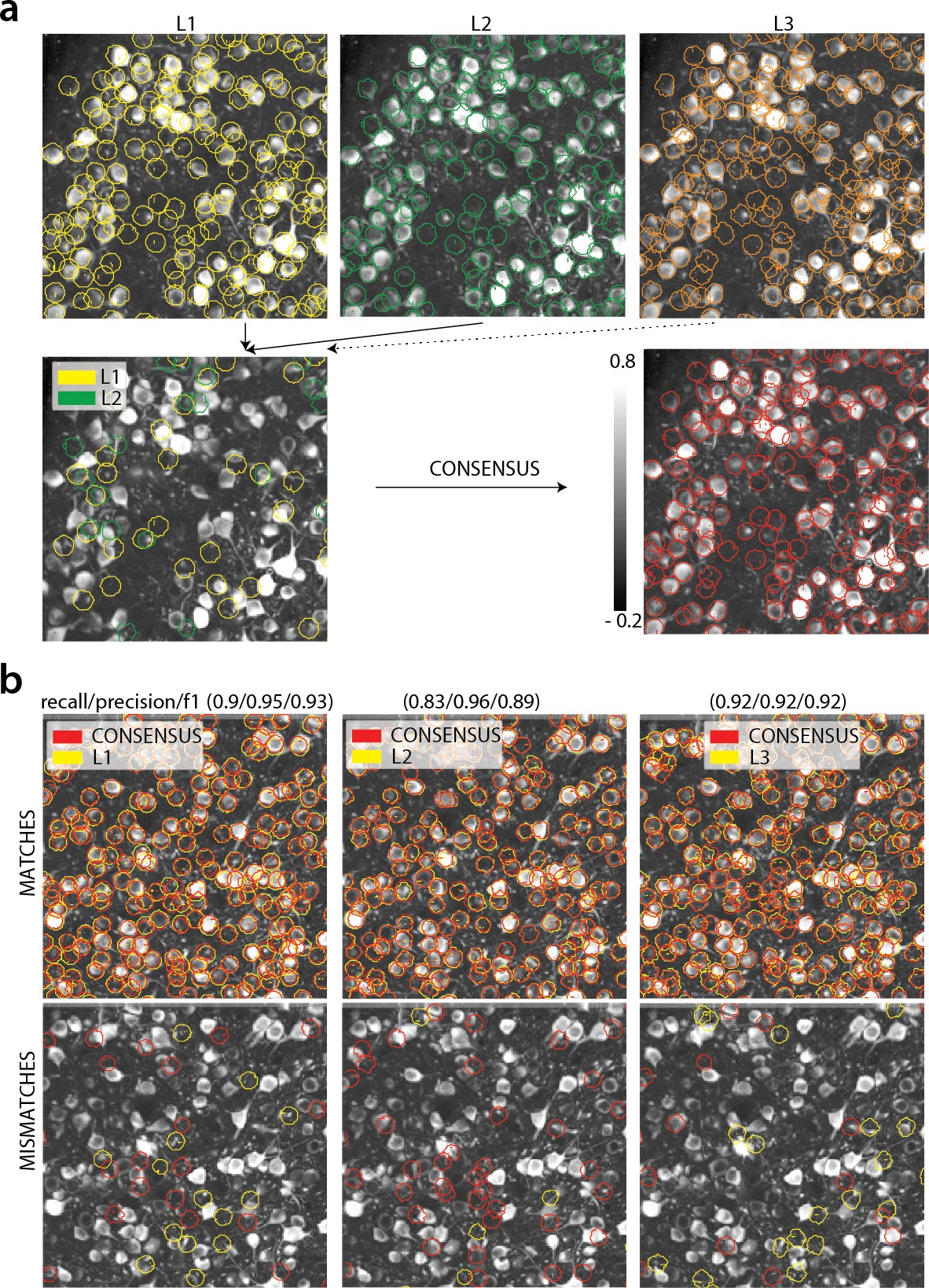CaImAn an open source tool for scalable calcium imaging data analysis ...