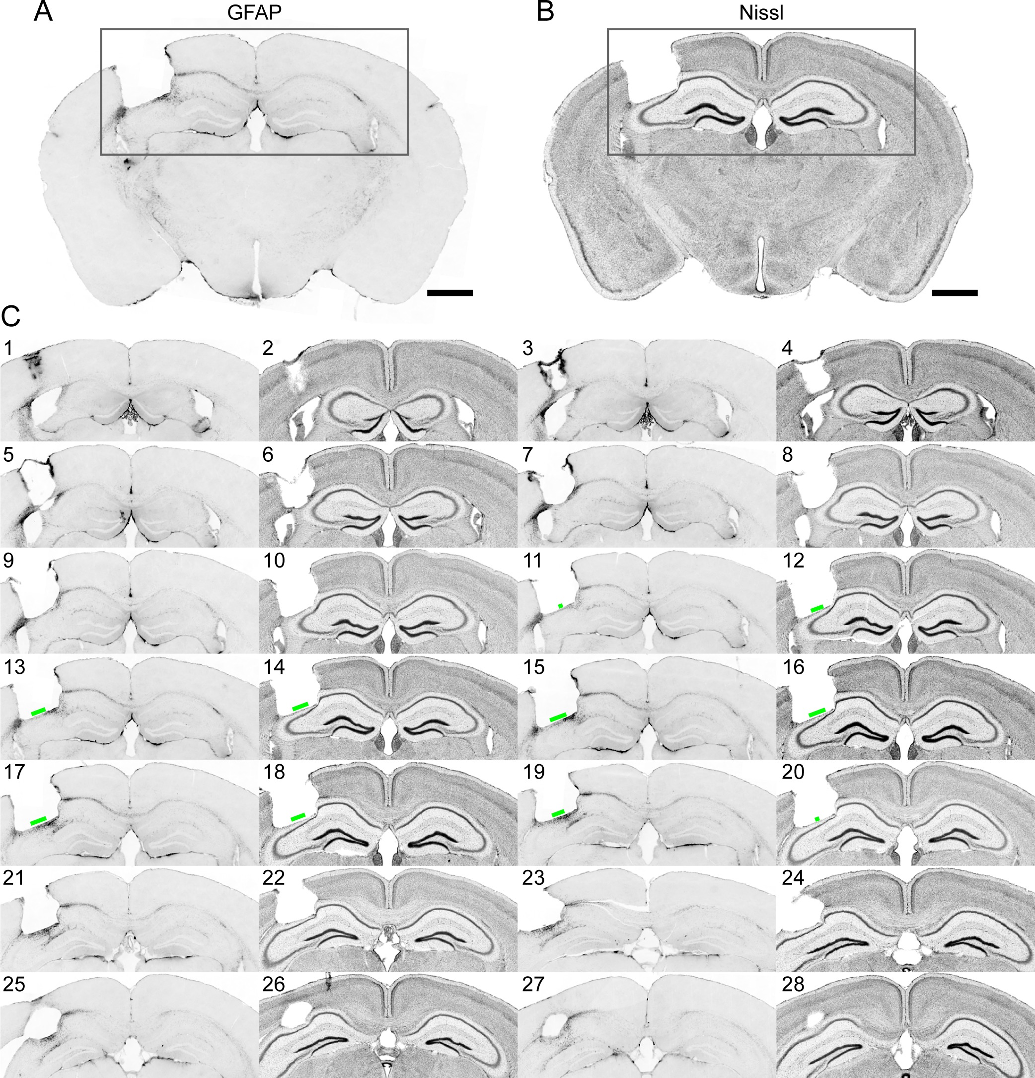 High-throughput synapse-resolving two-photon fluorescence ...