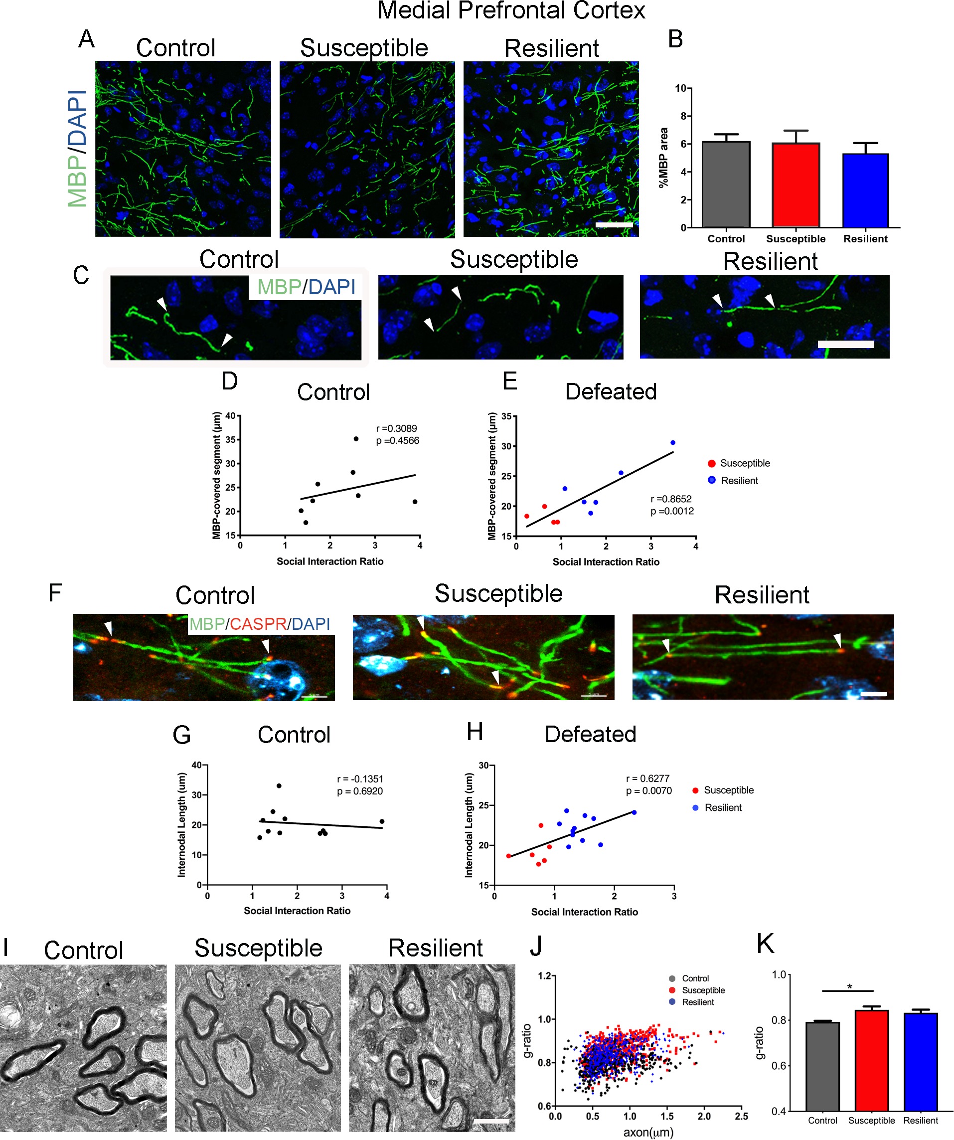 Region-specific myelin differences define behavioral consequences of ...