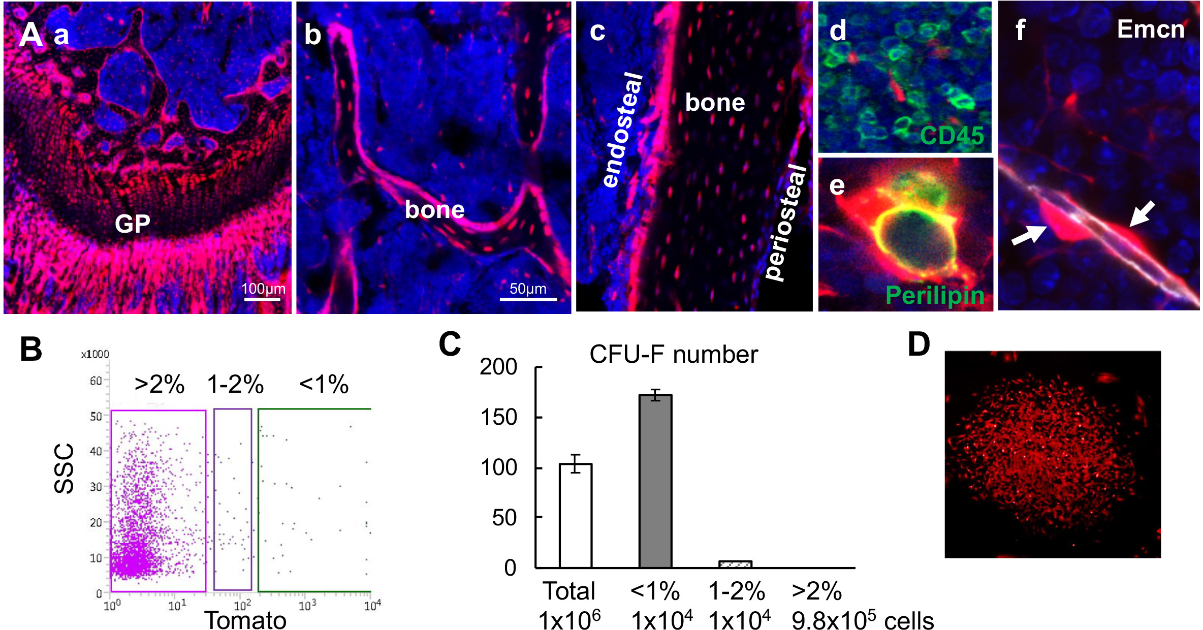 Single cell transcriptomics identifies a unique adipose lineage cell ...