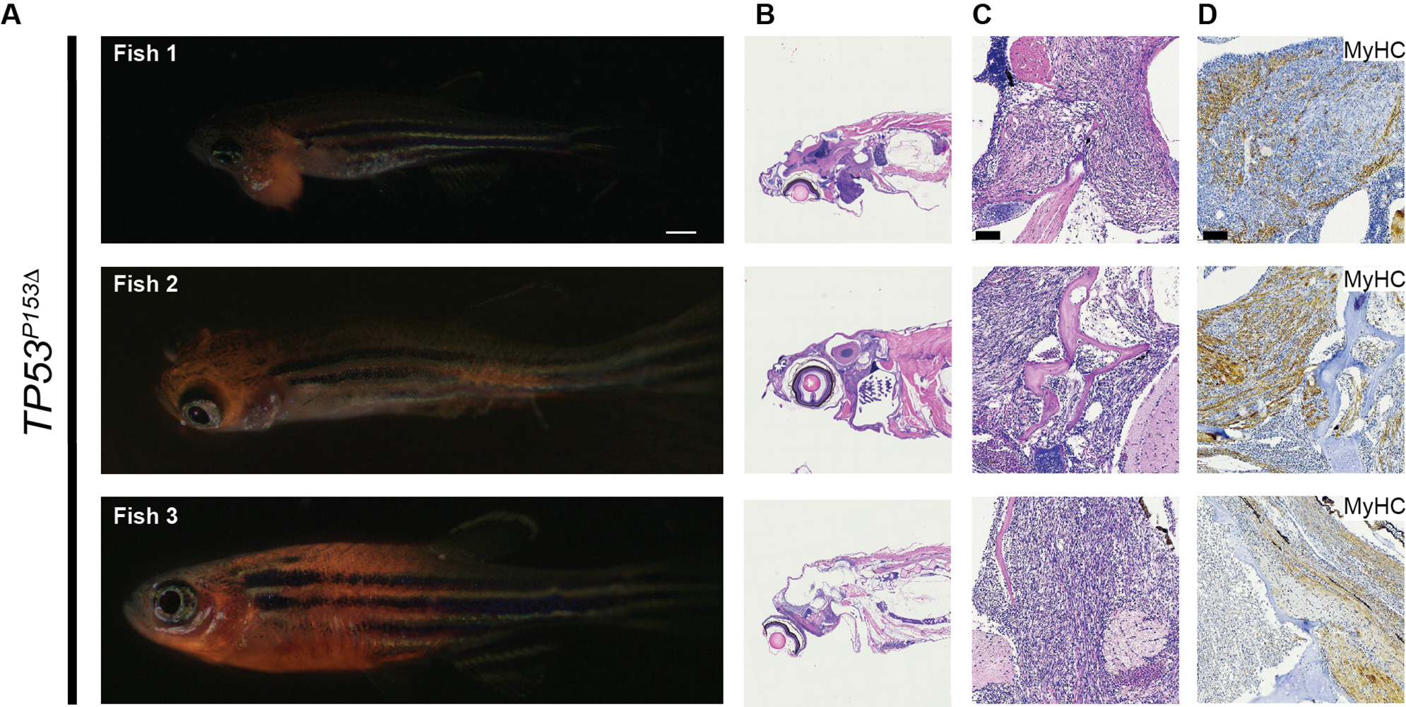 Defining function of wild-type and three patient-specific TP53 ...