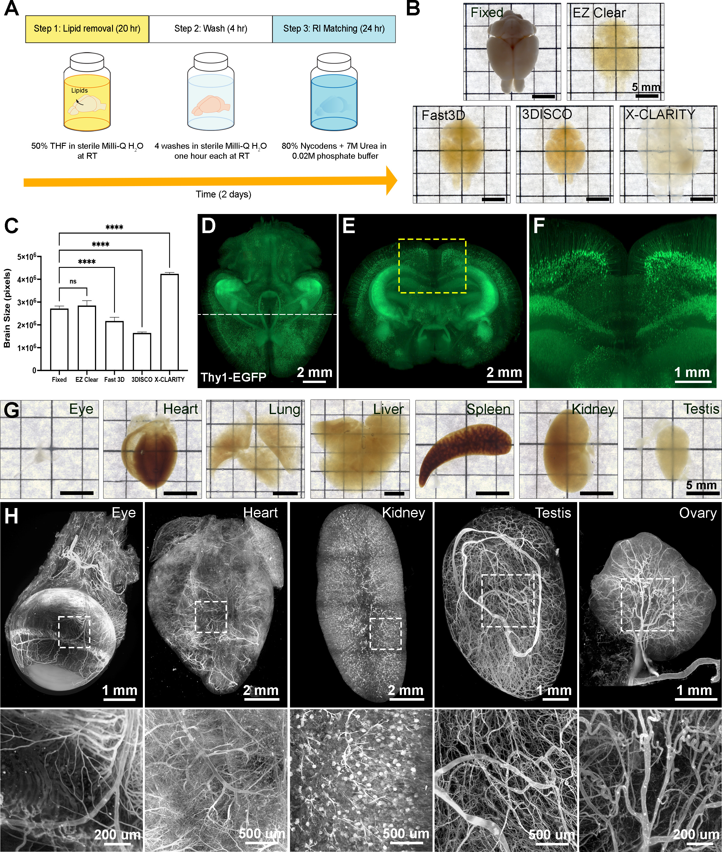 EZ Clear for simple, rapid, and robust mouse whole organ clearing ...