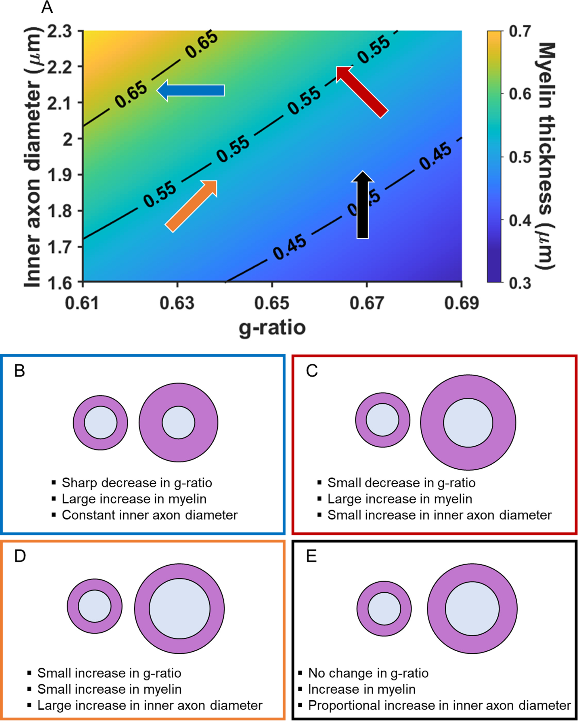 Conduction velocity along a key white matter tract is associated with ...