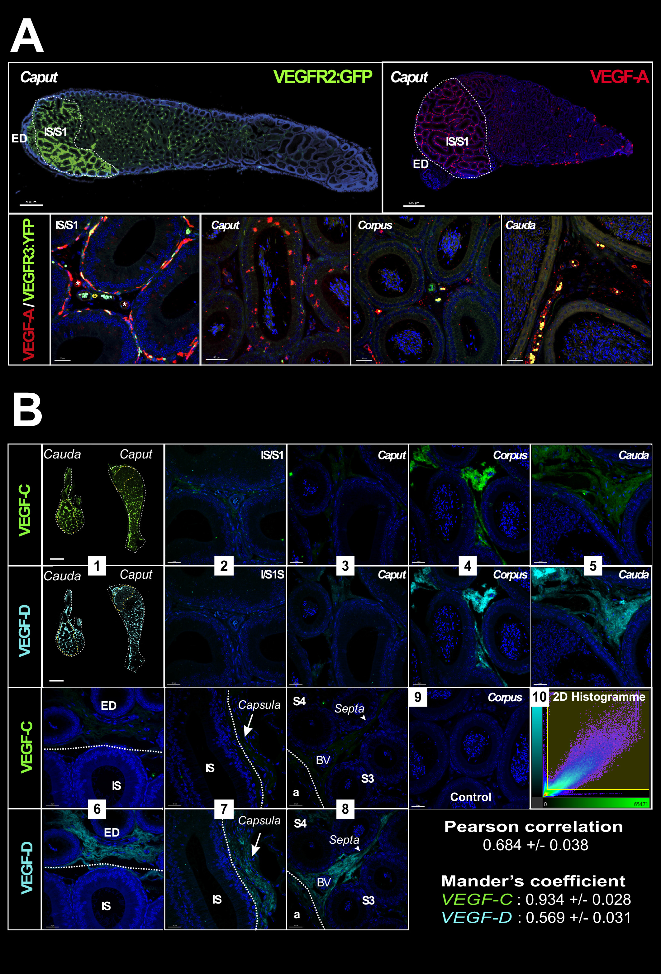 Three-dimensional imaging of vascular development in the mouse ...
