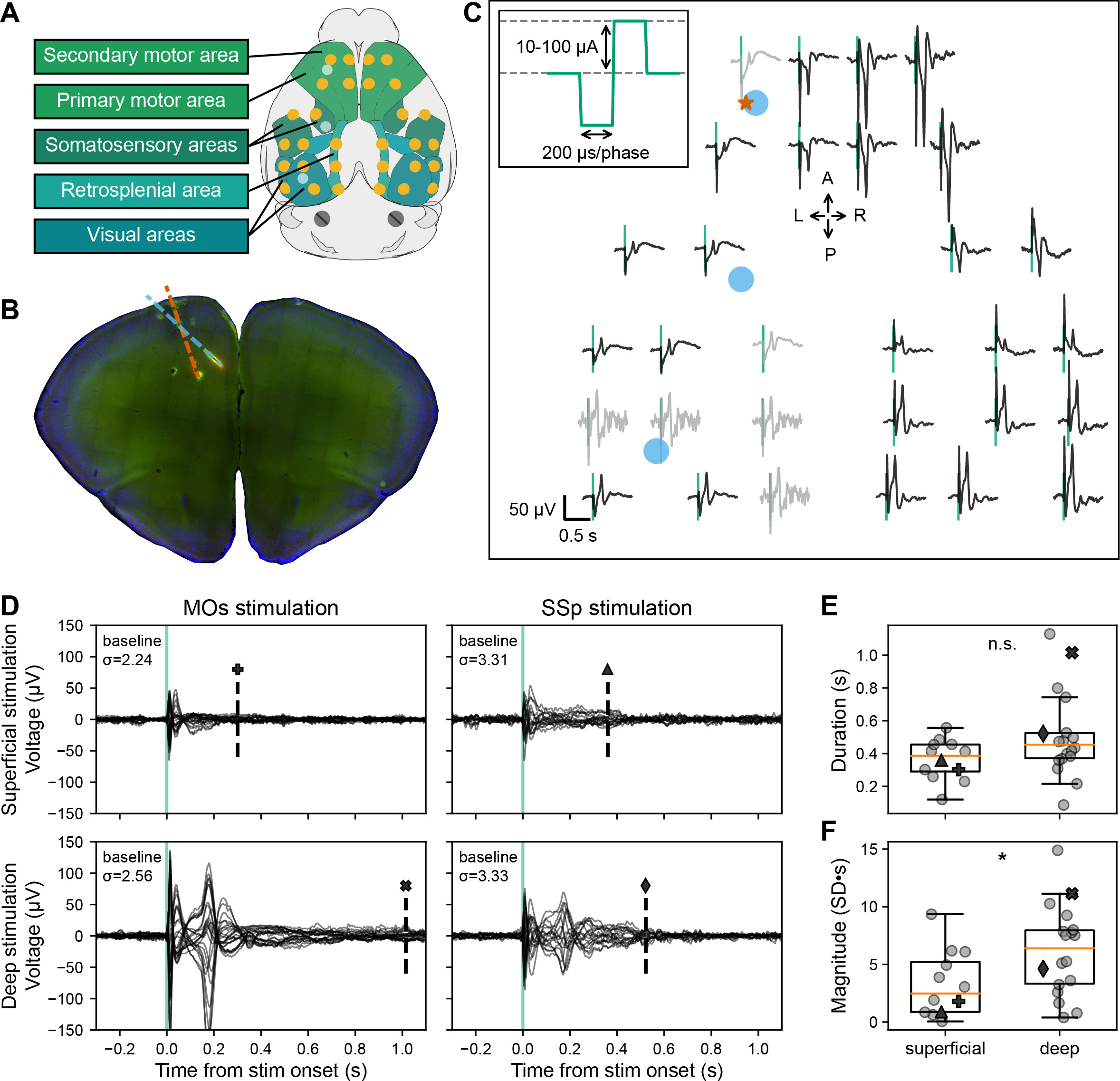 Cortico-thalamo-cortical interactions modulate electrically evoked EEG ...