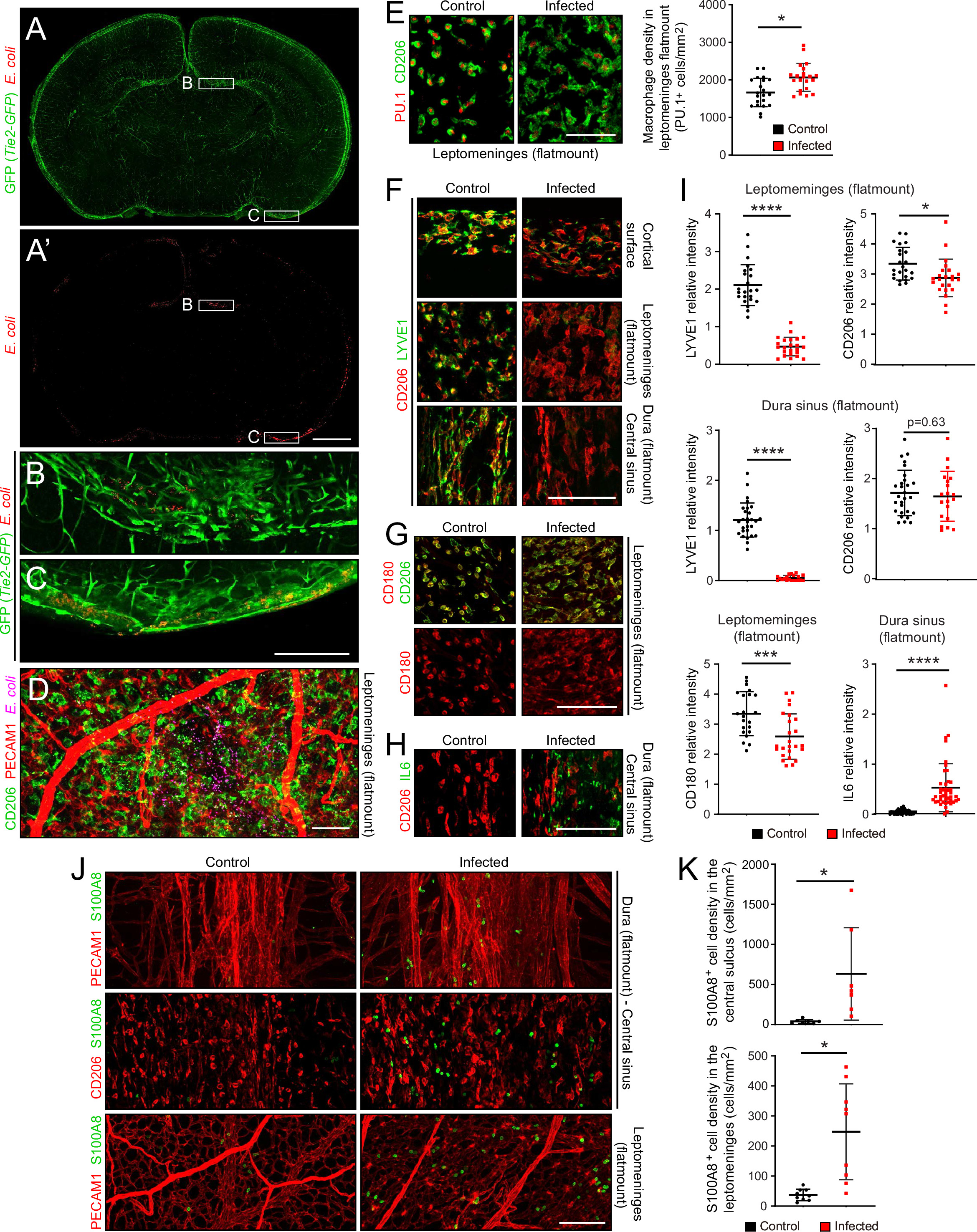 Bacterial meningitis in the early postnatal mouse studied at single ...