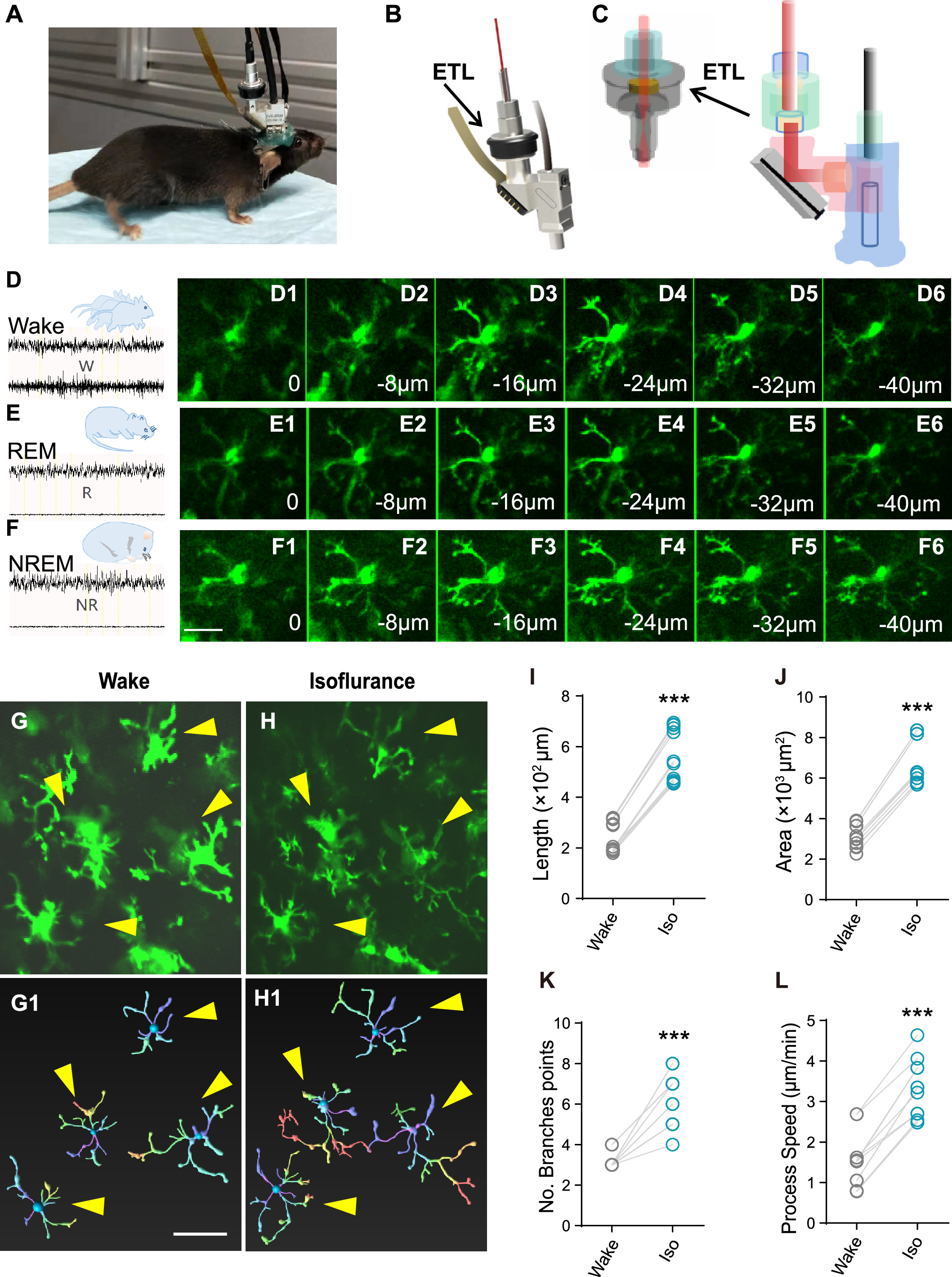 Imaging microglia surveillance during sleep-wake cycles in freely ...