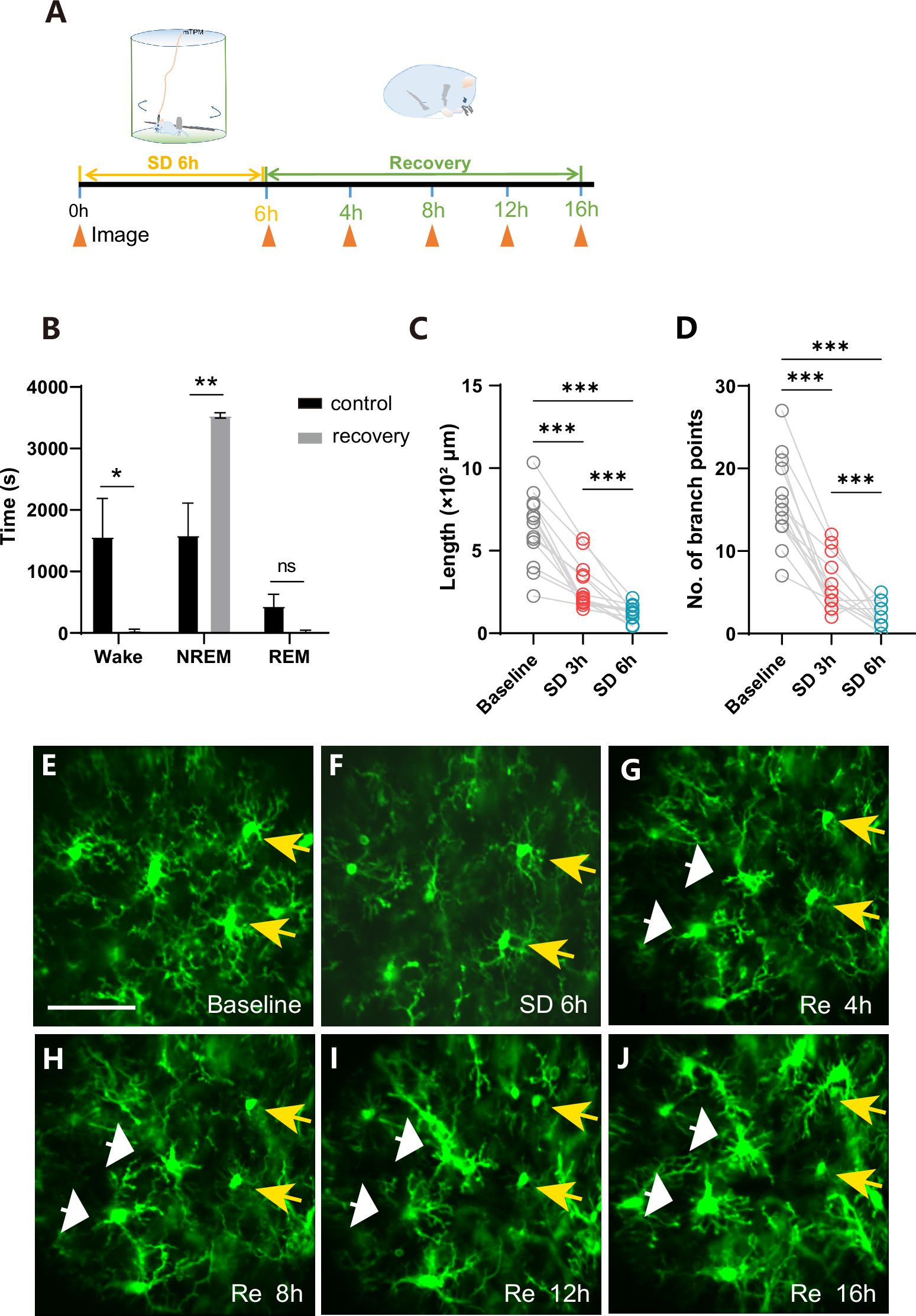 Imaging microglia surveillance during sleep-wake cycles in freely ...