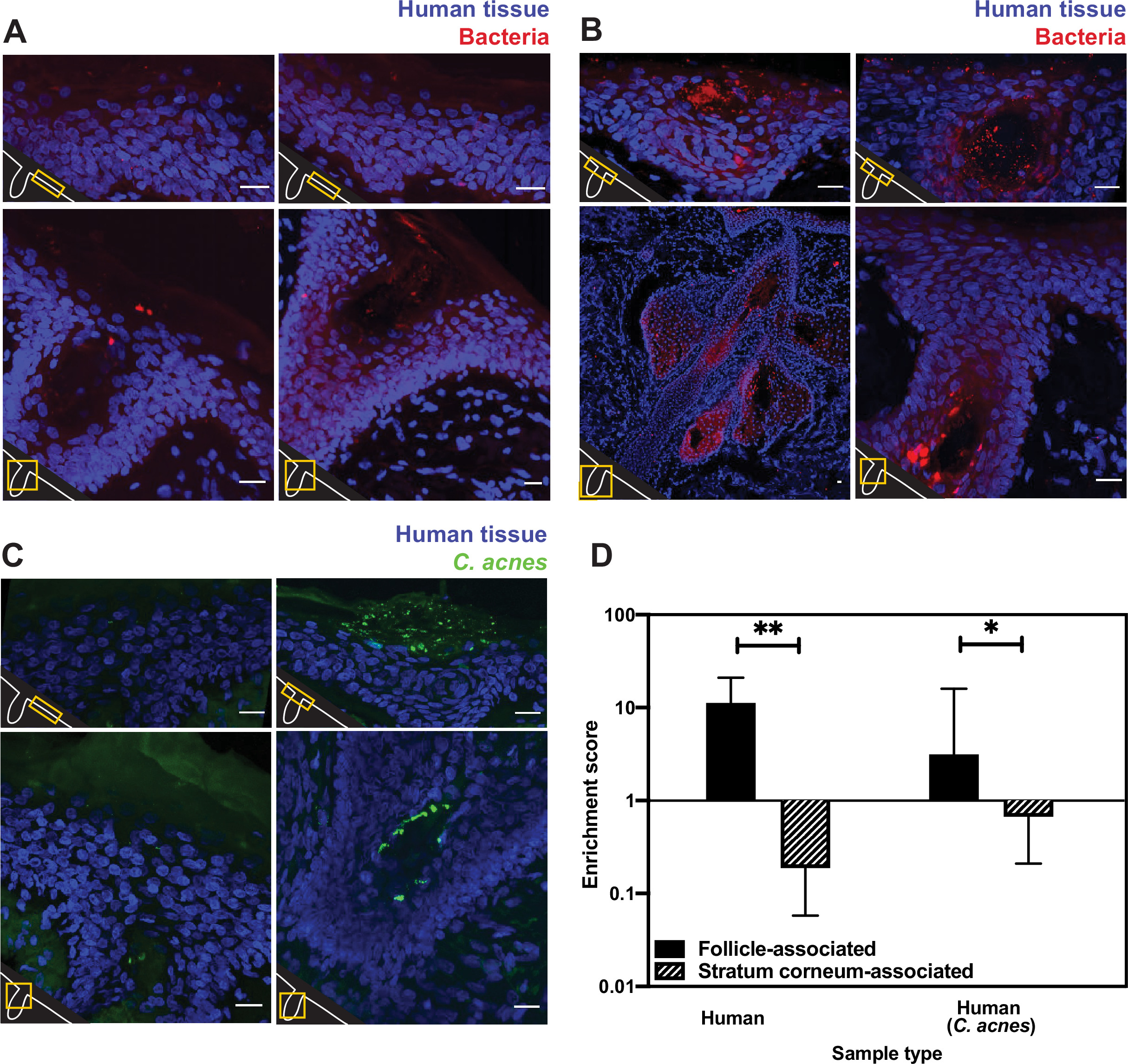 Bacterial DNA on the skin surface overrepresents the viable skin ...