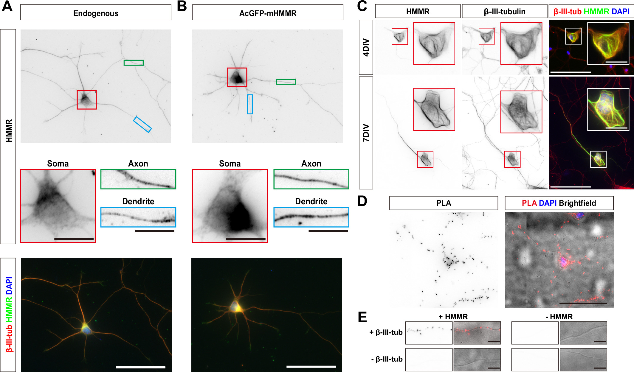 The non-mitotic role of HMMR in regulating the localization of TPX2 and ...