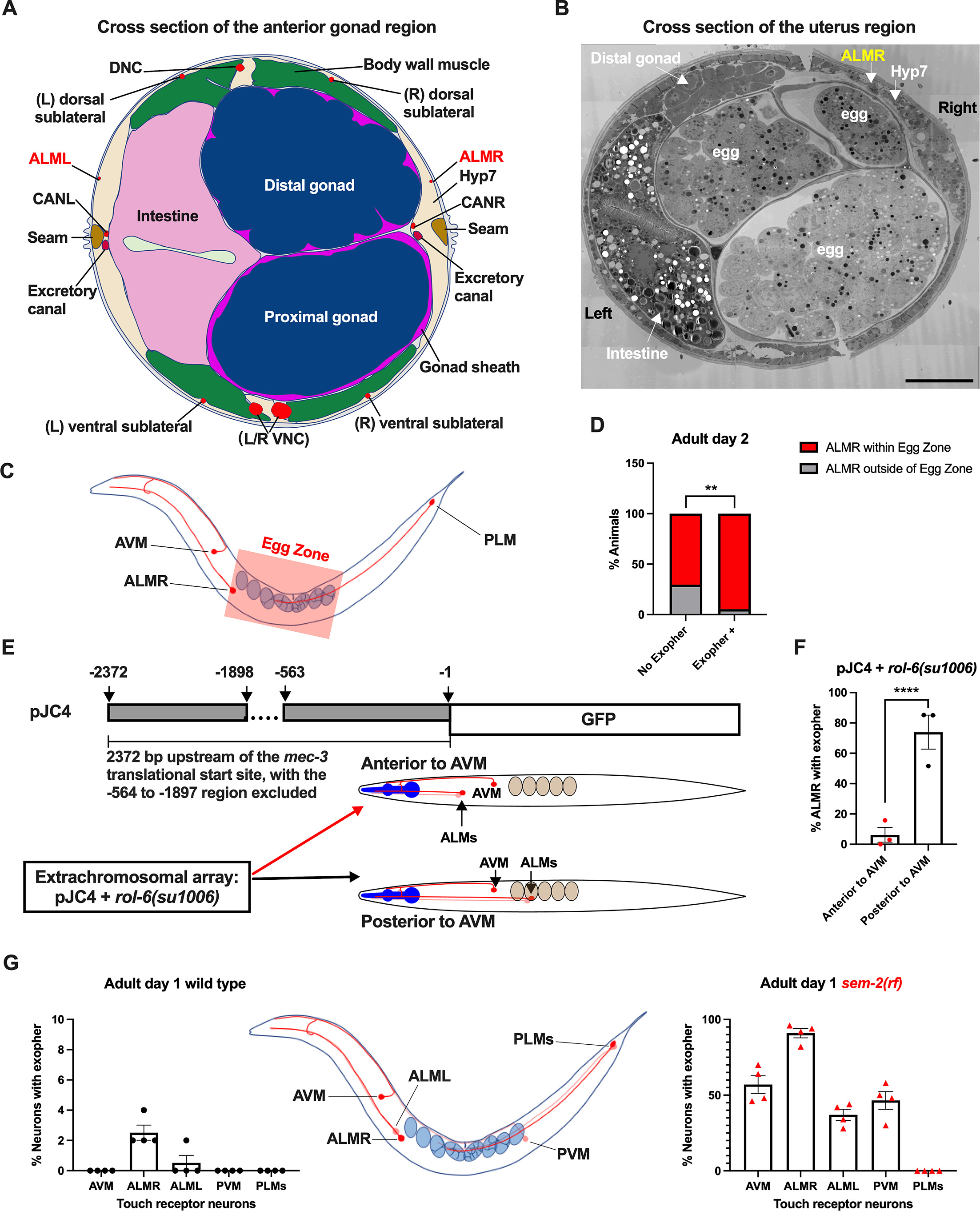 Mechanical force of uterine occupation enables large vesicle extrusion ...