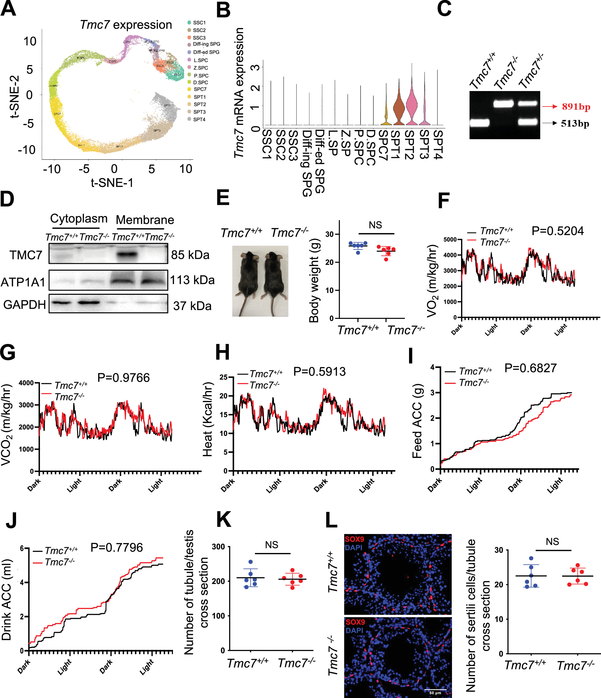 TMC7 deficiency causes acrosome biogenesis defects and male infertility ...